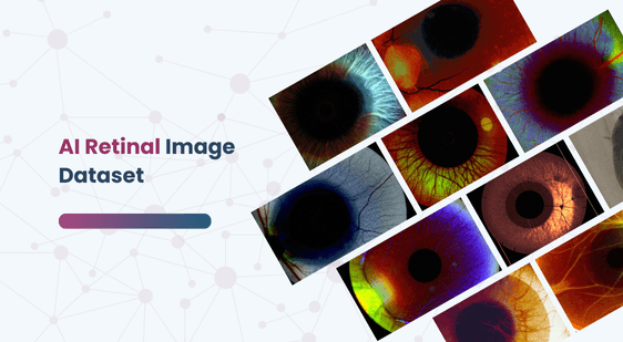 AI Retinal Image Dataset for Glaucoma Detection Research