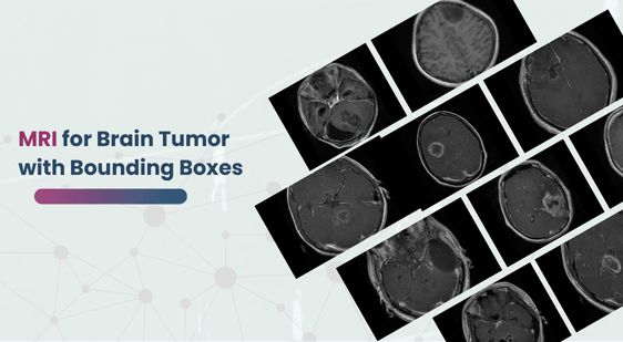 Brain Tumor Detection Dataset for Machine Learning